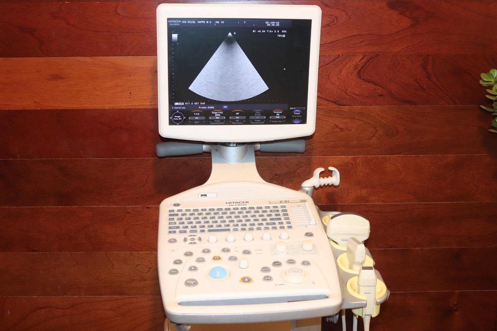 Hitachi Aloka Ultrasound F31 3 Probes Included – part2Go